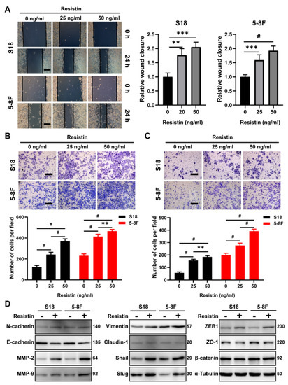 Resistin Promotes Nasopharyngeal Carcinoma Metastasis through TLR4 ...