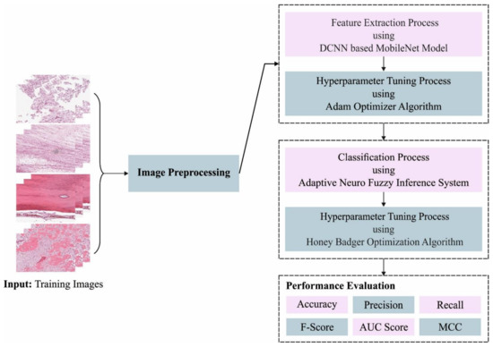 Design of a Honey Badger Optimization Algorithm with a Deep Transfer Learning-Based Osteosarcoma ...
