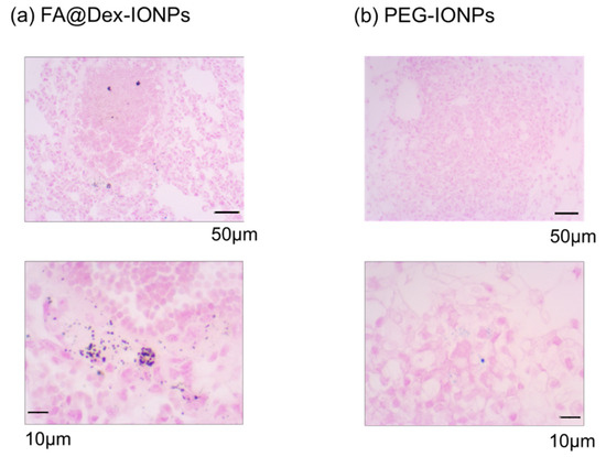 Targeted Imaging of Lung Cancer with Hyperpolarized 129Xe MRI Using ...