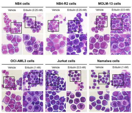 Cancers | Free Full-Text | Cellular and Molecular Effects of Eribulin ...