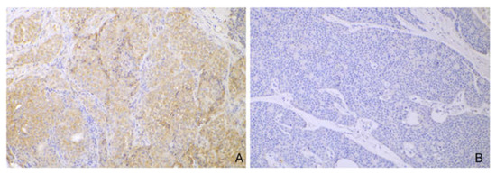 Development of Monoclonal Antibodies Targeting Canine PD-L1 and PD-1 ...