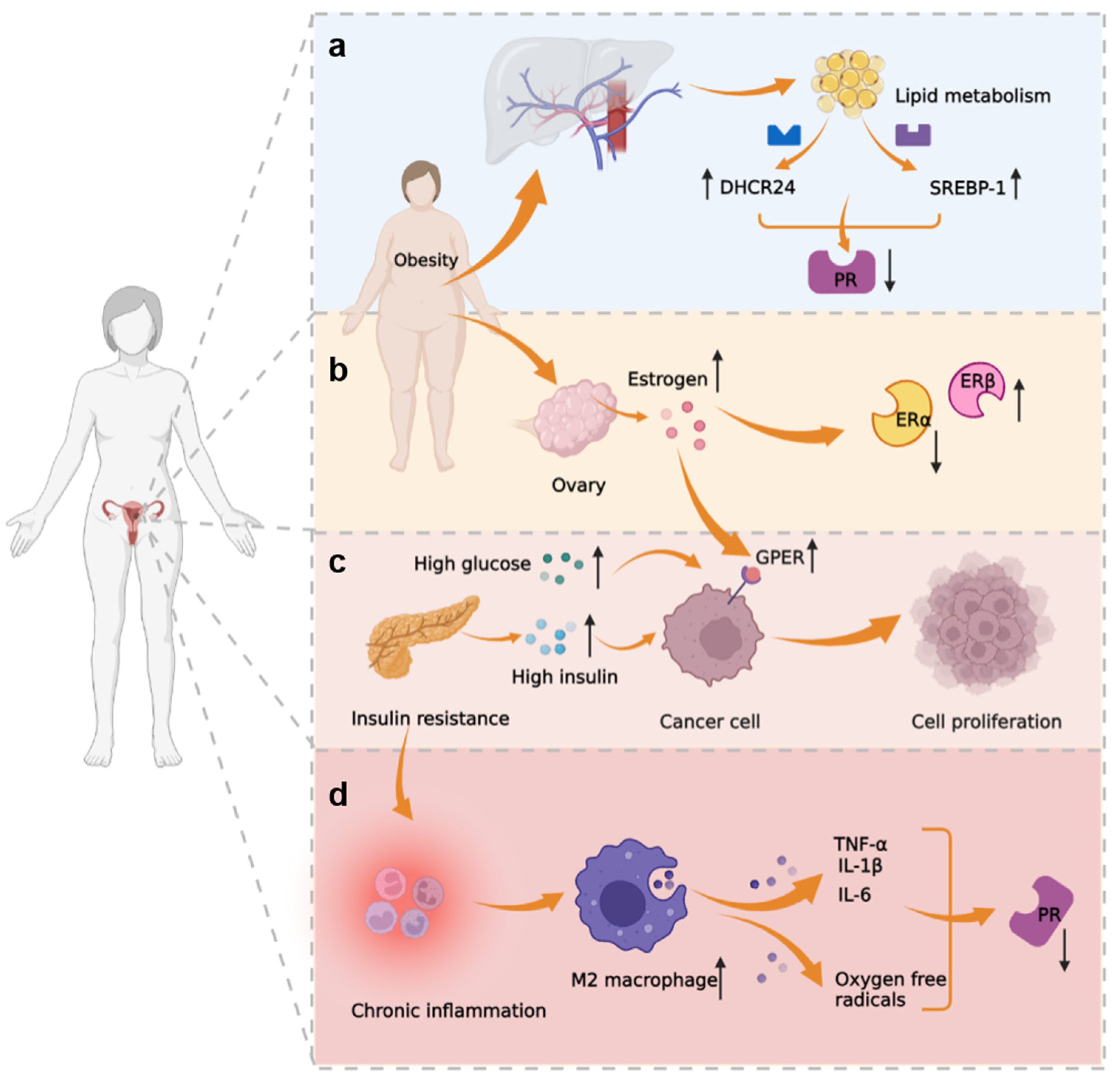 Progestin Resistance and Corresponding Management of Abnormal ...