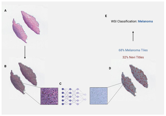 Diagnostic and Prognostic Deep Learning Applications for Histological ...