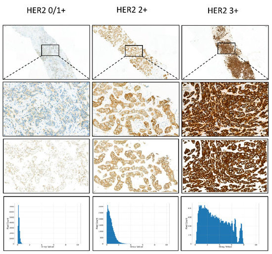 Using Whole Slide Gray Value Map to Predict HER2 Expression and FISH ...