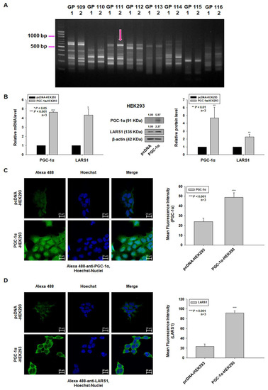 PGC-1α Regulates Cell Proliferation, Migration, and Invasion by ...