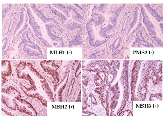Cancers | Free Full-Text | Evaluation of Microsatellite Instability ...