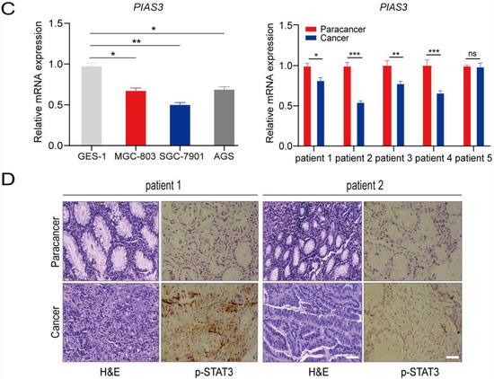 Palmitic Acid Inhibits the Growth and Metastasis of Gastric Cancer by ...