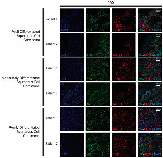 A Systemic and Integrated Analysis of p63-Driven Regulatory Networks in ...