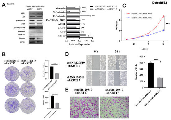 LncRNA NR120519 Blocks KRT17 to Promote Cell Proliferation and ...
