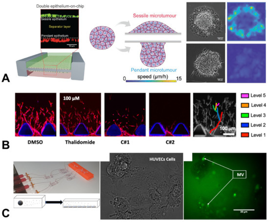 Organ-on-a-Chip and Microfluidic Platforms for Oncology in the UK