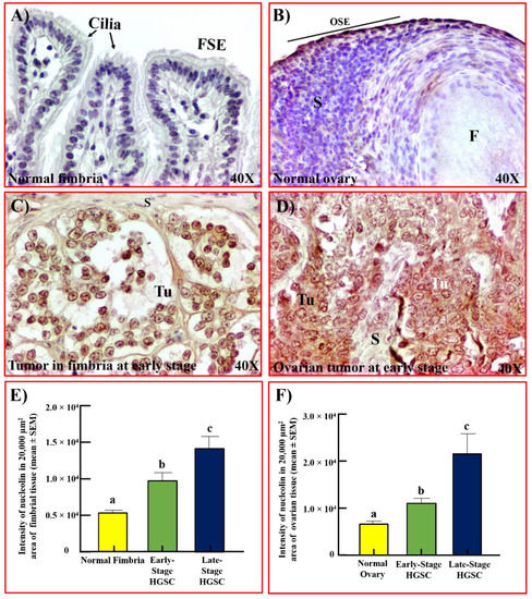 Changes in Nucleolin Expression during Malignant Transformation Leading ...