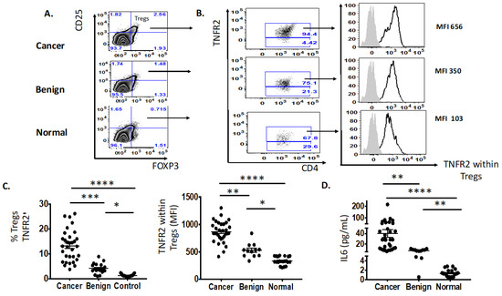 Combining TNFR2-Expressing Tregs and IL-6 as Superior Diagnostic Biomarkers for High-Grade ...