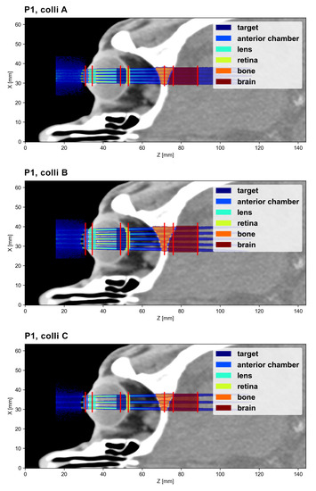 Orthovoltage X-ray Minibeam Radiation Therapy for the Treatment of ...