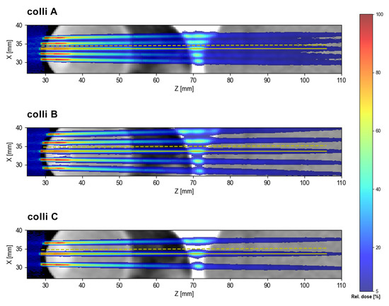 Orthovoltage X-ray Minibeam Radiation Therapy for the Treatment of ...