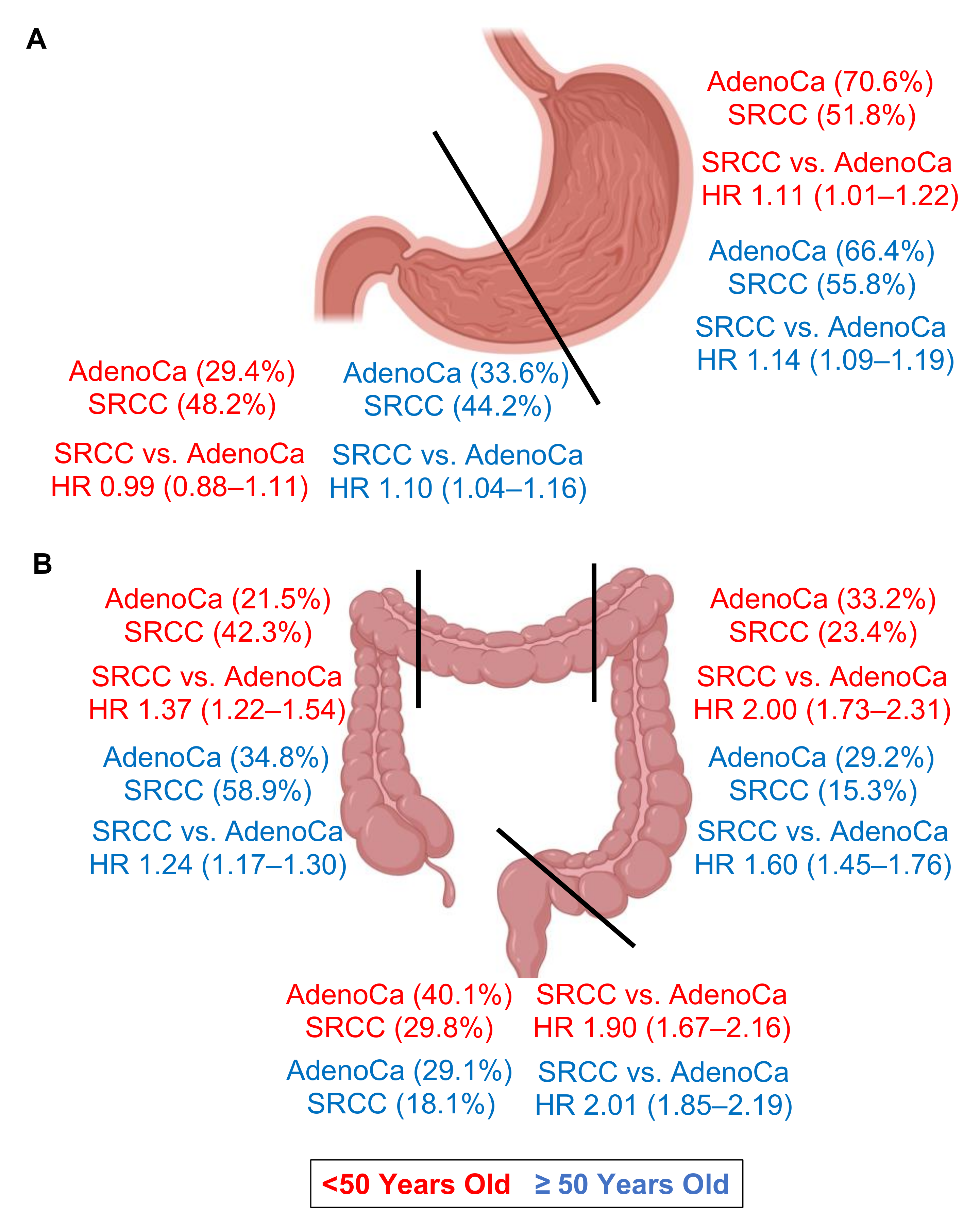 Cancers Free Full Text Effects Of Tumor Localization Age And