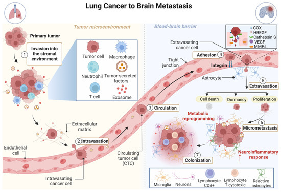 Advances in the Molecular Landscape of Lung Cancer Brain Metastasis