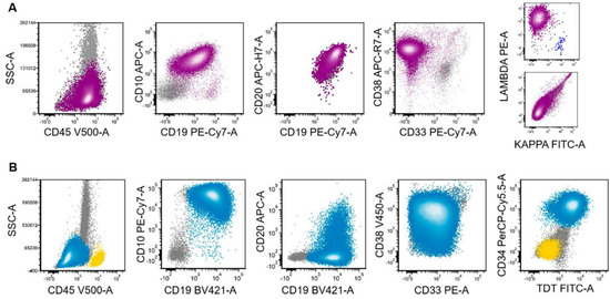 Blastoid B-Cell Neoplasms: Diagnostic Challenges and Solutions