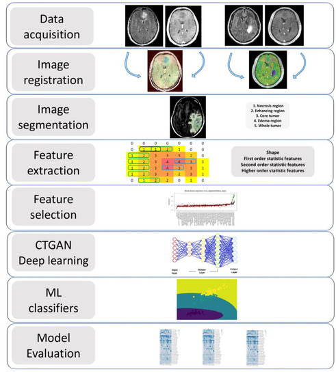 MRI-Based Radiomics Combined with Deep Learning for Distinguishing IDH-Mutant WHO Grade 4 ...