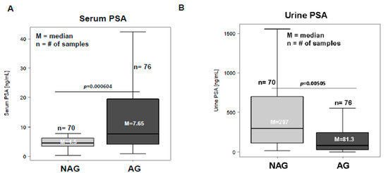 Urinary PSA and Serum PSA for Aggressive Prostate Cancer Detection