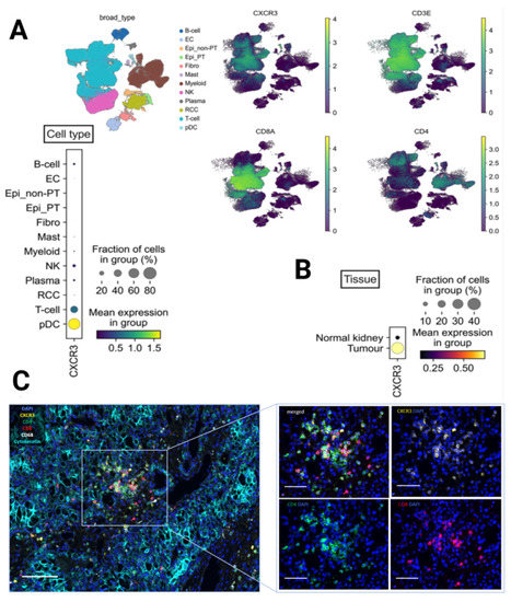 CXCR3 Expression Is Associated with Advanced Tumor Stage and Grade ...