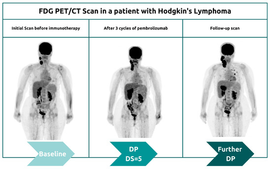 FDG-PET/CT in the Monitoring of Lymphoma Immunotherapy Response: Current Status and Future Prospects