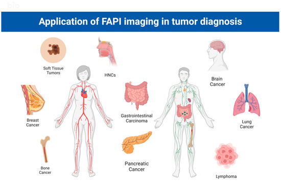 Cancers | Free Full-Text | The Superiority of Fibroblast Activation Protein Inhibitor (FAPI) PET ...