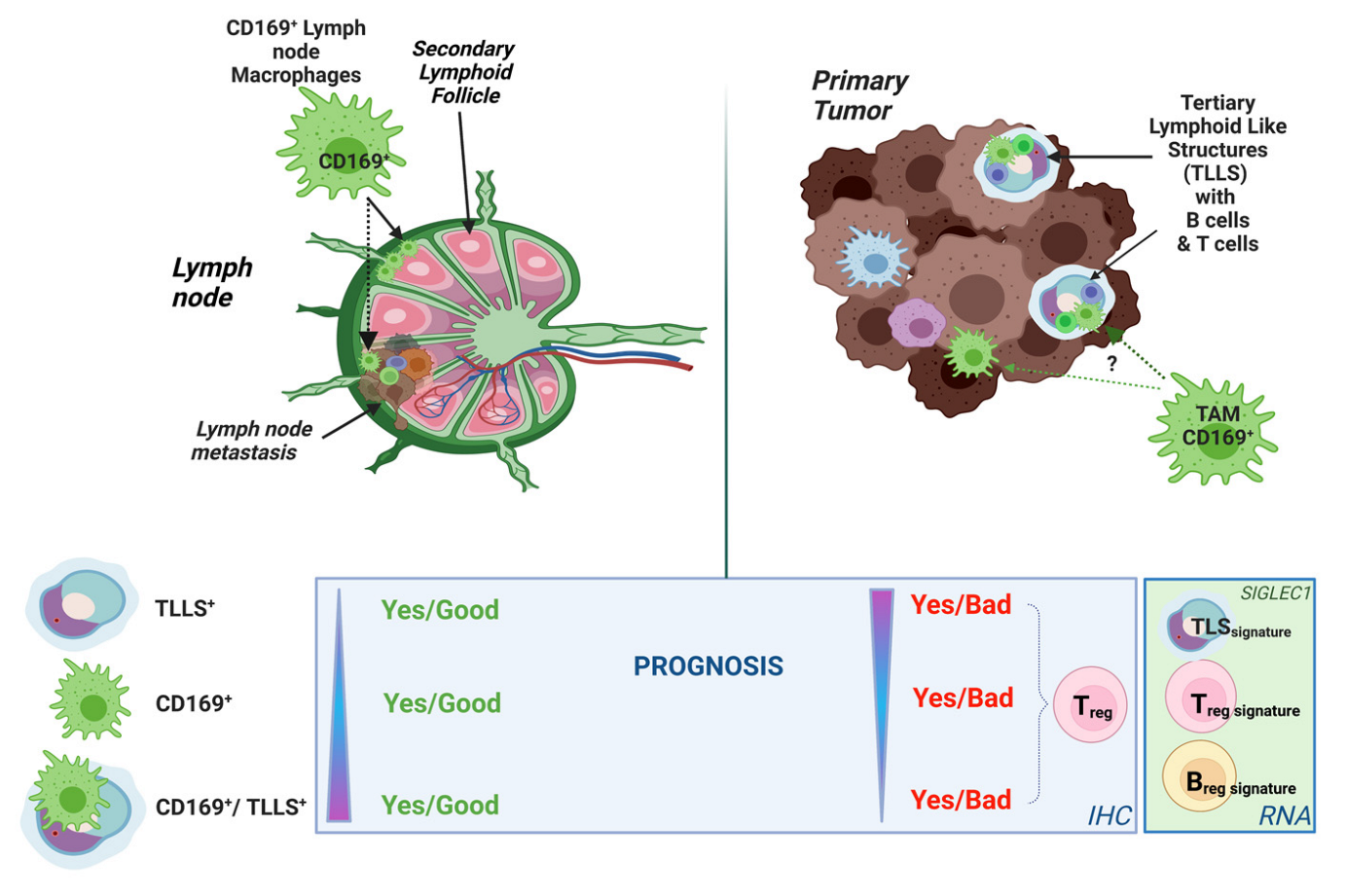 CD169+ Macrophages in Primary Breast Tumors Associate with Tertiary Lymphoid Structures, Tregs ...