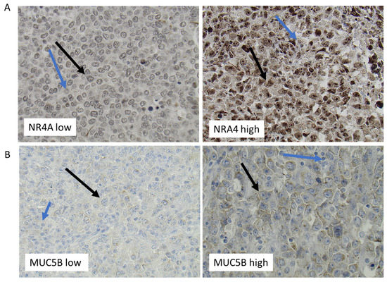 Cancers Free Full Text Sex And Female Age Dependent Differences In