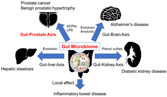 The Gut-Prostate Axis: A New Perspective of Prostate Cancer Biology ...