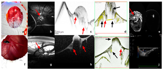 Chick Chorioallantoic Membrane as a Patient-Derived Xenograft Model for ...
