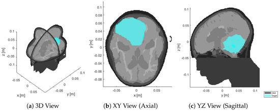 Antenna Arrangement in UWB Helmet Brain Applicators for Deep Microwave ...