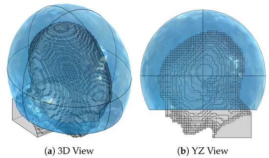 Antenna Arrangement in UWB Helmet Brain Applicators for Deep Microwave ...