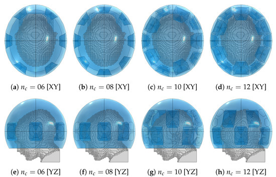 Antenna Arrangement in UWB Helmet Brain Applicators for Deep Microwave ...