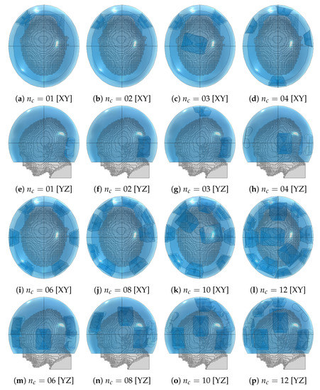Antenna Arrangement in UWB Helmet Brain Applicators for Deep Microwave ...