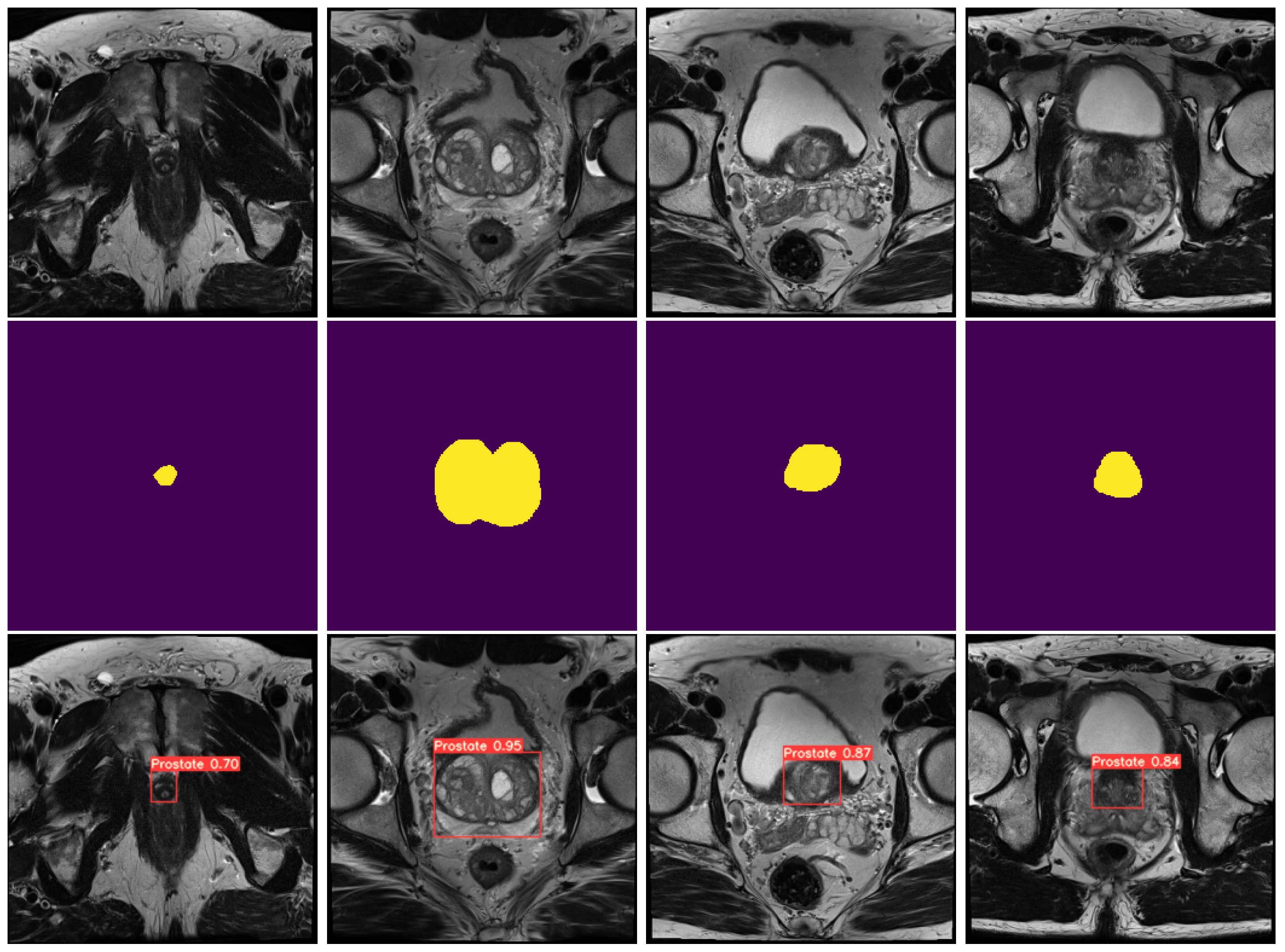 A Comparative Study of Automated Deep Learning Segmentation Models for Prostate MRI