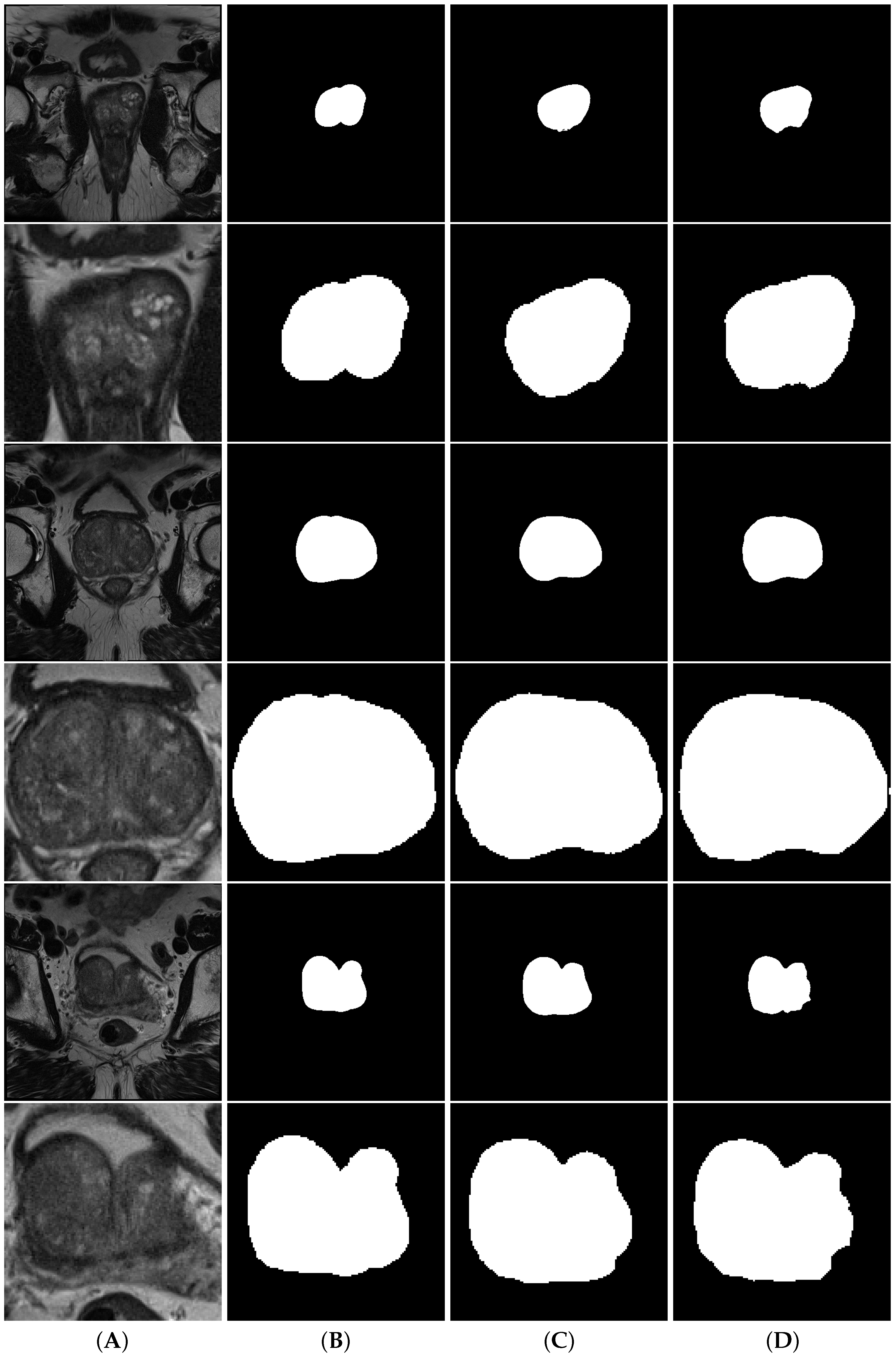 A Comparative Study of Automated Deep Learning Segmentation Models for Prostate MRI