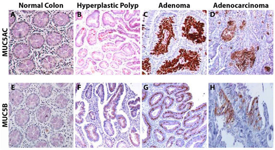 The Mucin Family of Proteins: Candidates as Potential Biomarkers for ...