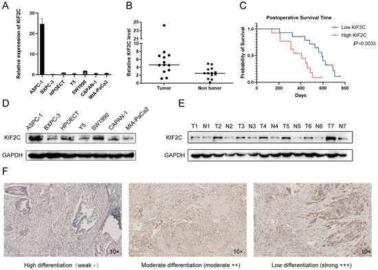 KIF2C Facilitates Tumor Growth and Metastasis in Pancreatic Ductal ...