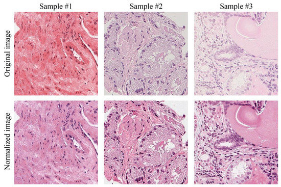Impact of Stain Normalization on Pathologist Assessment of Prostate ...