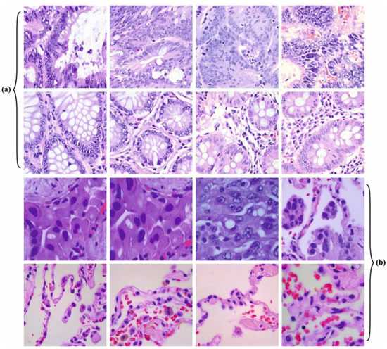 Leveraging Marine Predators Algorithm with Deep Learning for Lung and ...