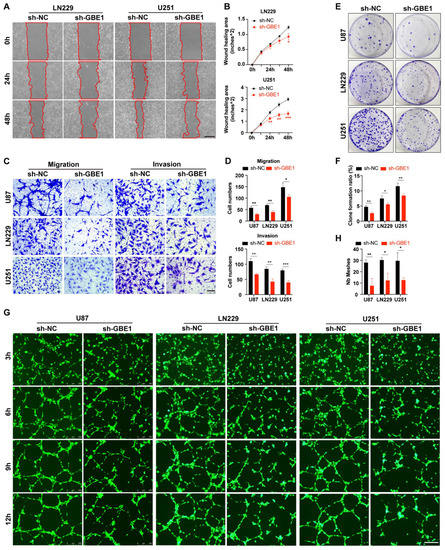 GBE1 Promotes Glioma Progression by Enhancing Aerobic Glycolysis ...