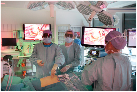 The Surgical Management of Lung Neuroendocrine Neoplasms