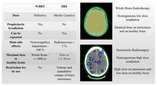 How Stereotactic Radiotherapy Changed the Landscape in Cancer Care