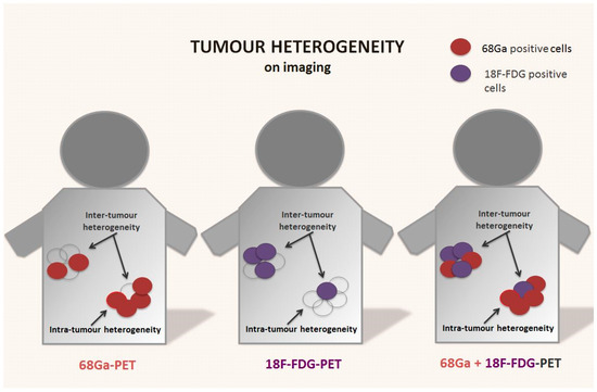 Tumour Heterogeneity and the Consequent Practical Challenges in the ...