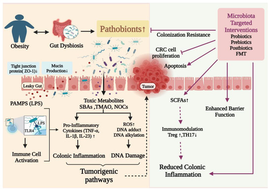 Implication of Obesity and Gut Microbiome Dysbiosis in the Etiology of Colorectal Cancer