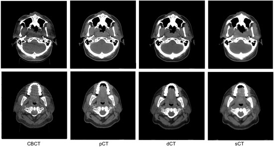 CBCT-to-CT Translation Using Registration-Based Generative Adversarial ...