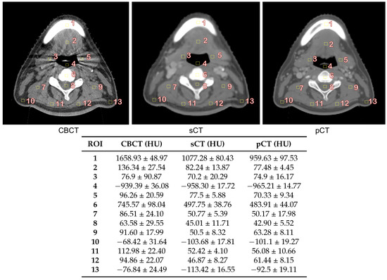 CBCT-to-CT Translation Using Registration-Based Generative Adversarial ...