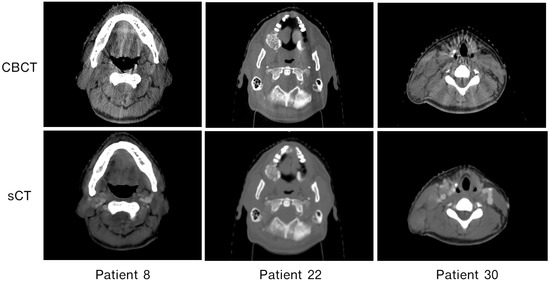 CBCT-to-CT Translation Using Registration-Based Generative Adversarial ...