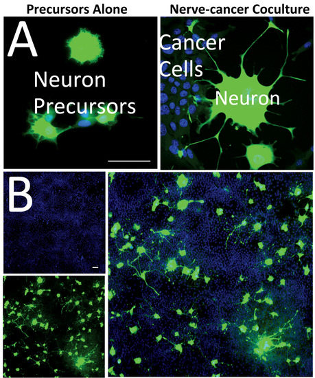 A CRISPR/Cas9-Based Assay for High-Throughput Studies of Cancer-Induced ...