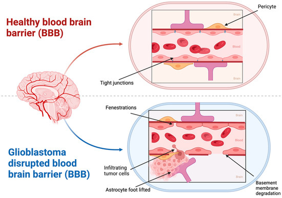 Mechanisms of Resistance and Current Treatment Options for Glioblastoma ...
